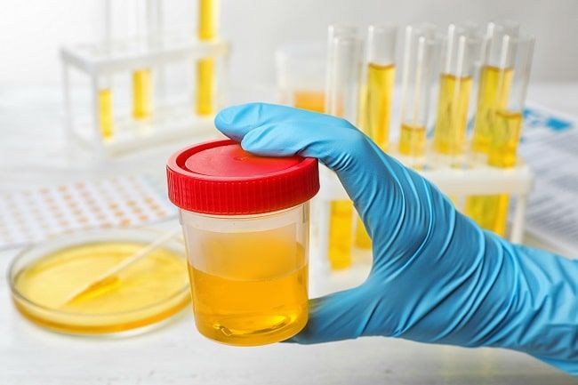 GoRiau - Uji 29 Sampel Urine Perangkat Desa di Bengkalis, Hasilnya ...